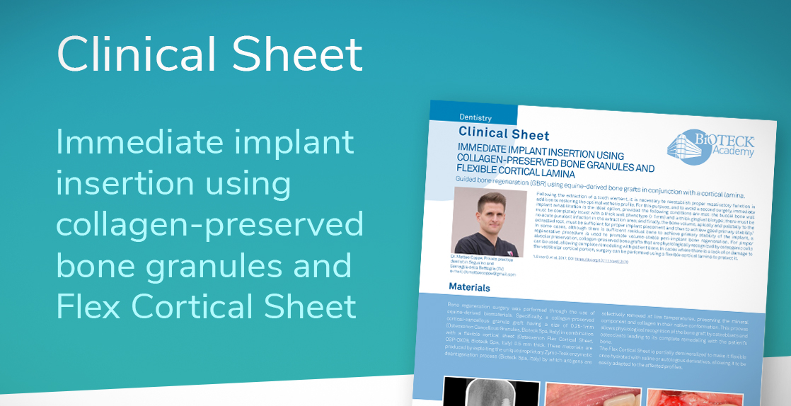 flex cortical sheet